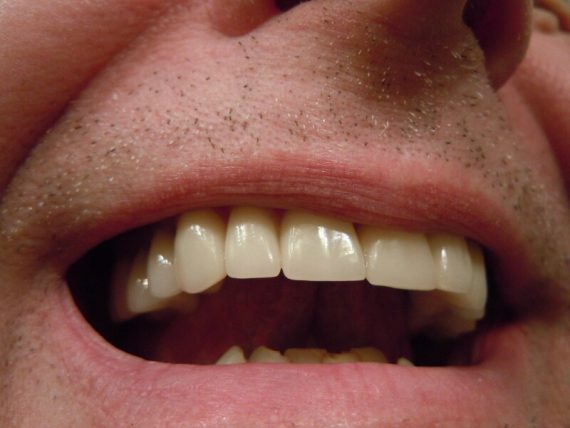 Dental Photography - Your Ultimate Guide! - Ehab Photography